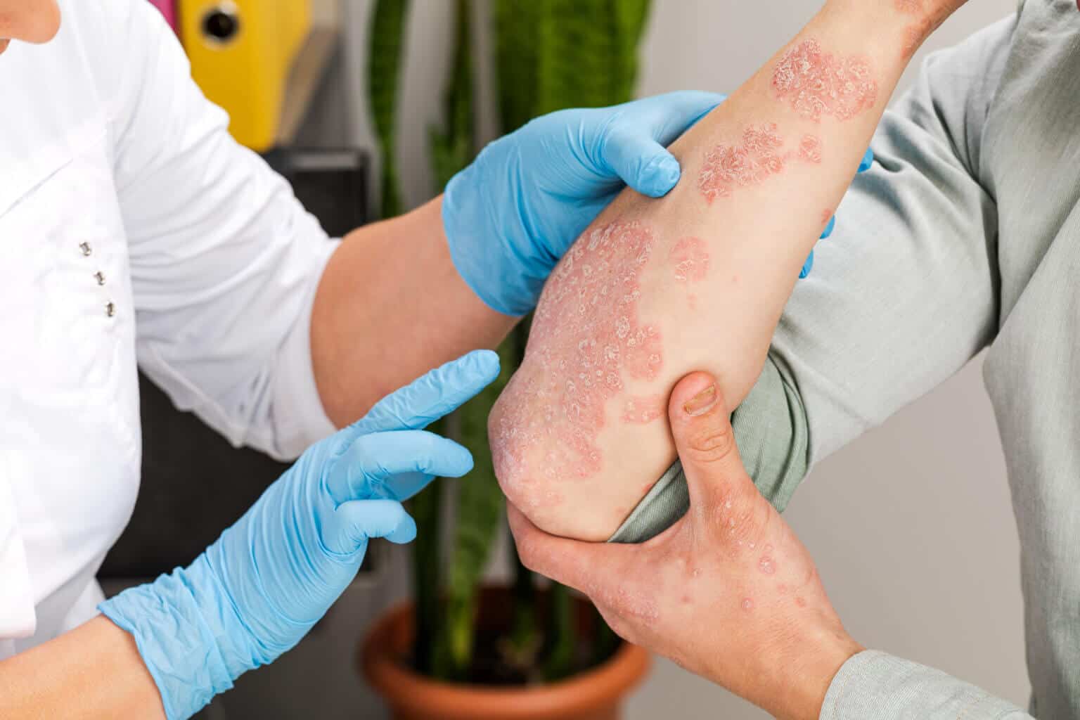 Dermatological Conditions: Understanding Common Skin Disorders